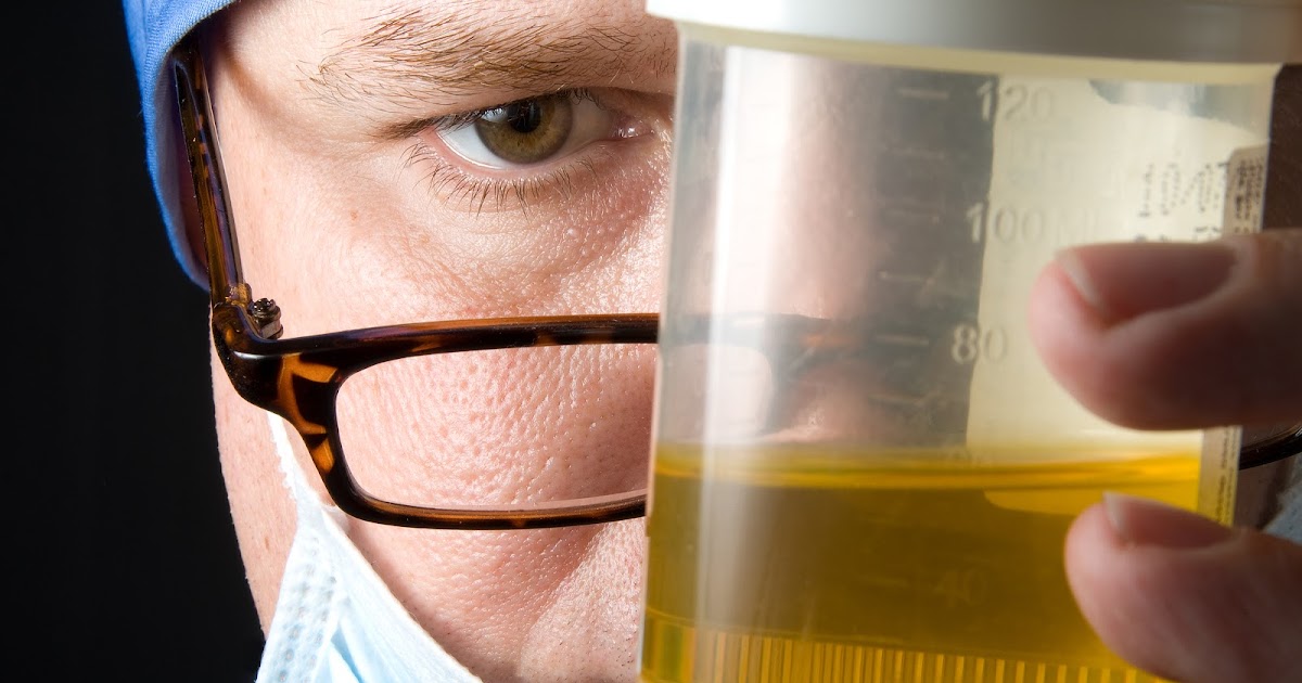 Urine Protein dan Rasio Urine Protein pada Kreatinin. Bag. 2 - Imad ...