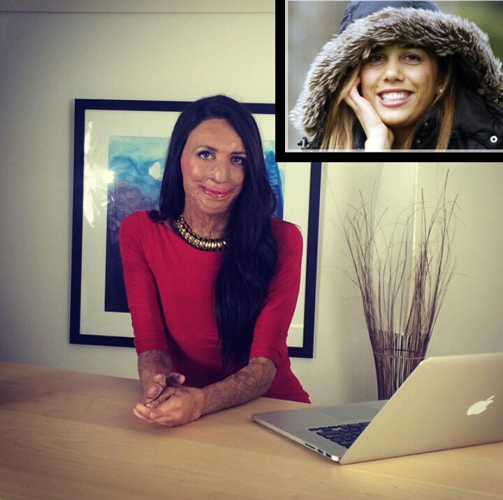 Hearts and Crafts: Heroine and Role Model; Turia Pitt
