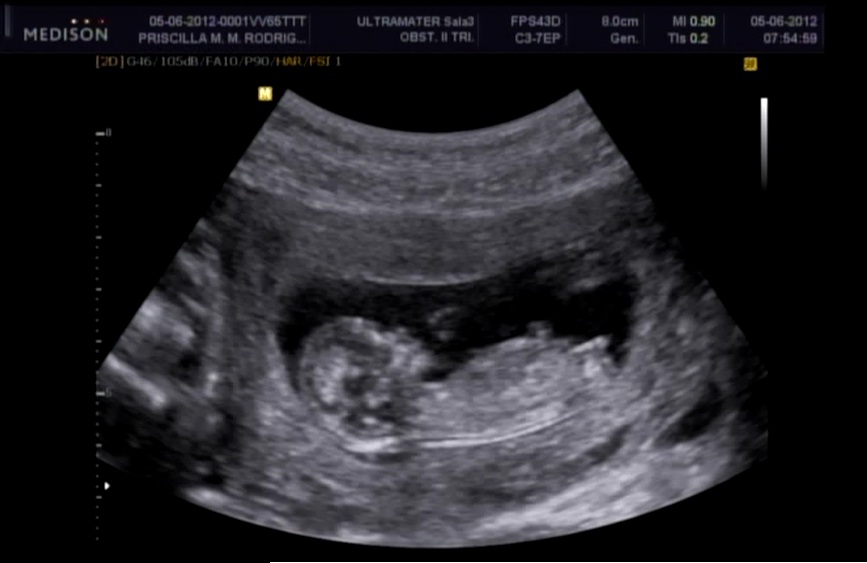 SCRAPS & BOOKS: Ultrassom de 12 semanas!