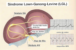 Dr. Rafael Soto - Electrocardiografía - Cardiología clínica: Síndrome ...