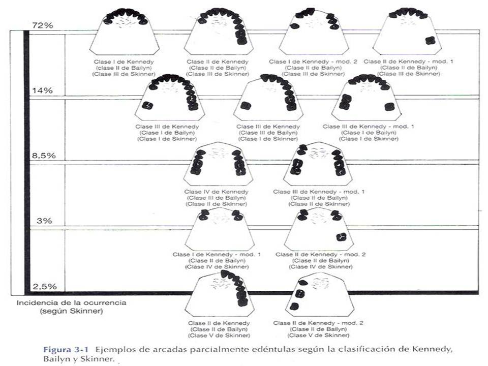REHABILITACIÓN II: Unidad II Clasificación de los Arcos Parcialmente ...