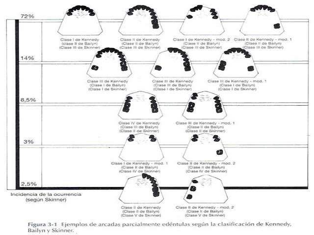 REHABILITACIÓN II: Unidad II Clasificación de los Arcos Parcialmente ...