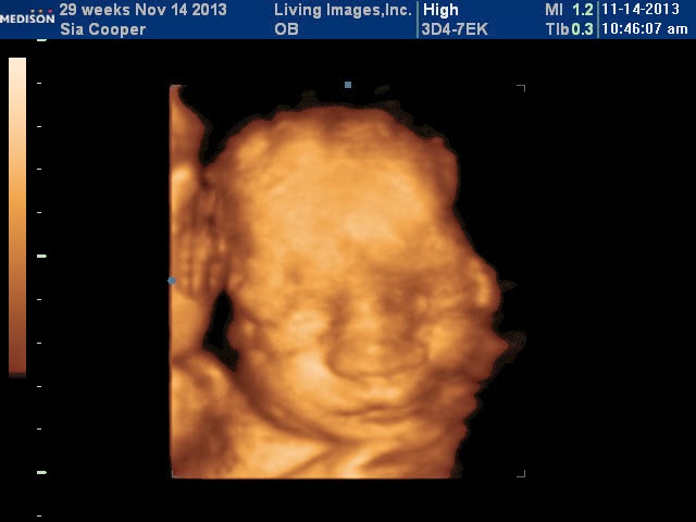 Diary of a Fit Mommy: More From Our 4D Session!