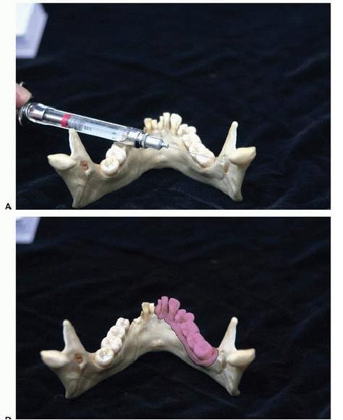 Dentistry lectures for MFDS/MJDF/NBDE/ORE: Anatomical Considerations in ...