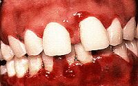 dental zone: periodontics