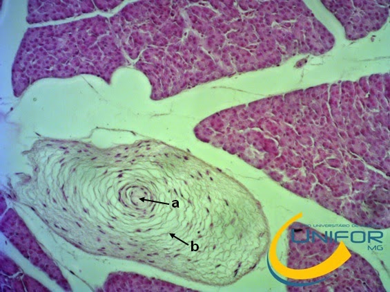 Atlas Histológico UNIFOR-MG: Corpúsculo de Vatter Pacini