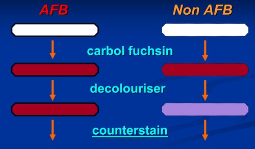 ZN staining technique for Acid Fast Bacilli: Demonstration Video ...