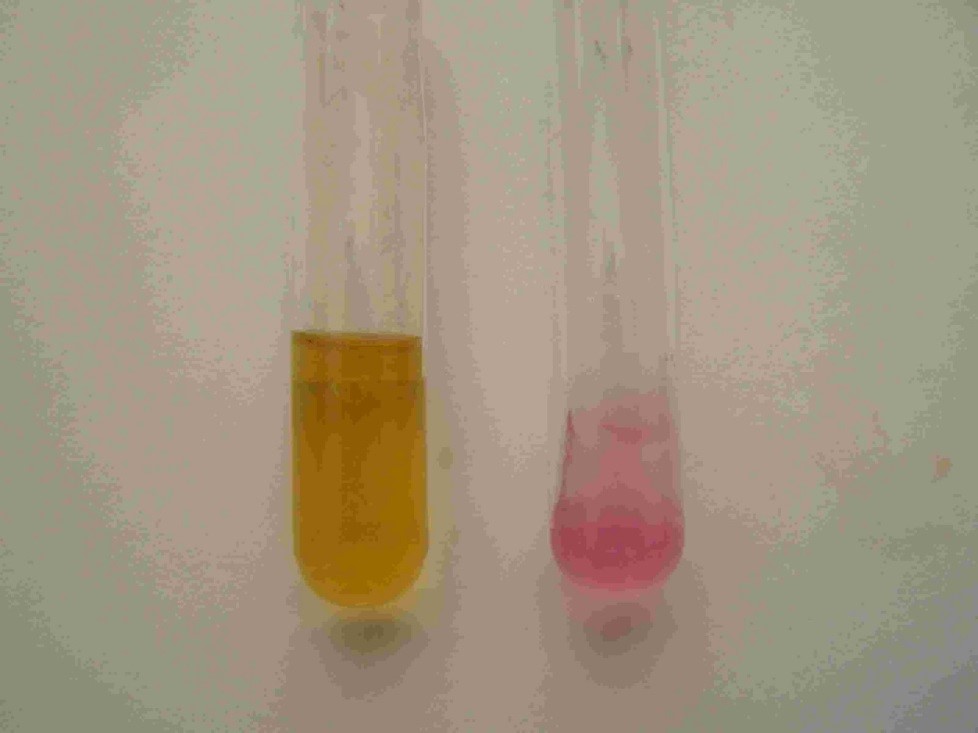 Laporan Praktikum Mikrobiologi Umum Identifikasi Bakteri Melalui Uji ...