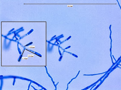 Fun With Microbiology (What's Buggin' You?): Trichophyton terrestre