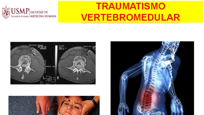 Especialidades I - Traumatismo Vertebro-medular | USMP FN Archivos