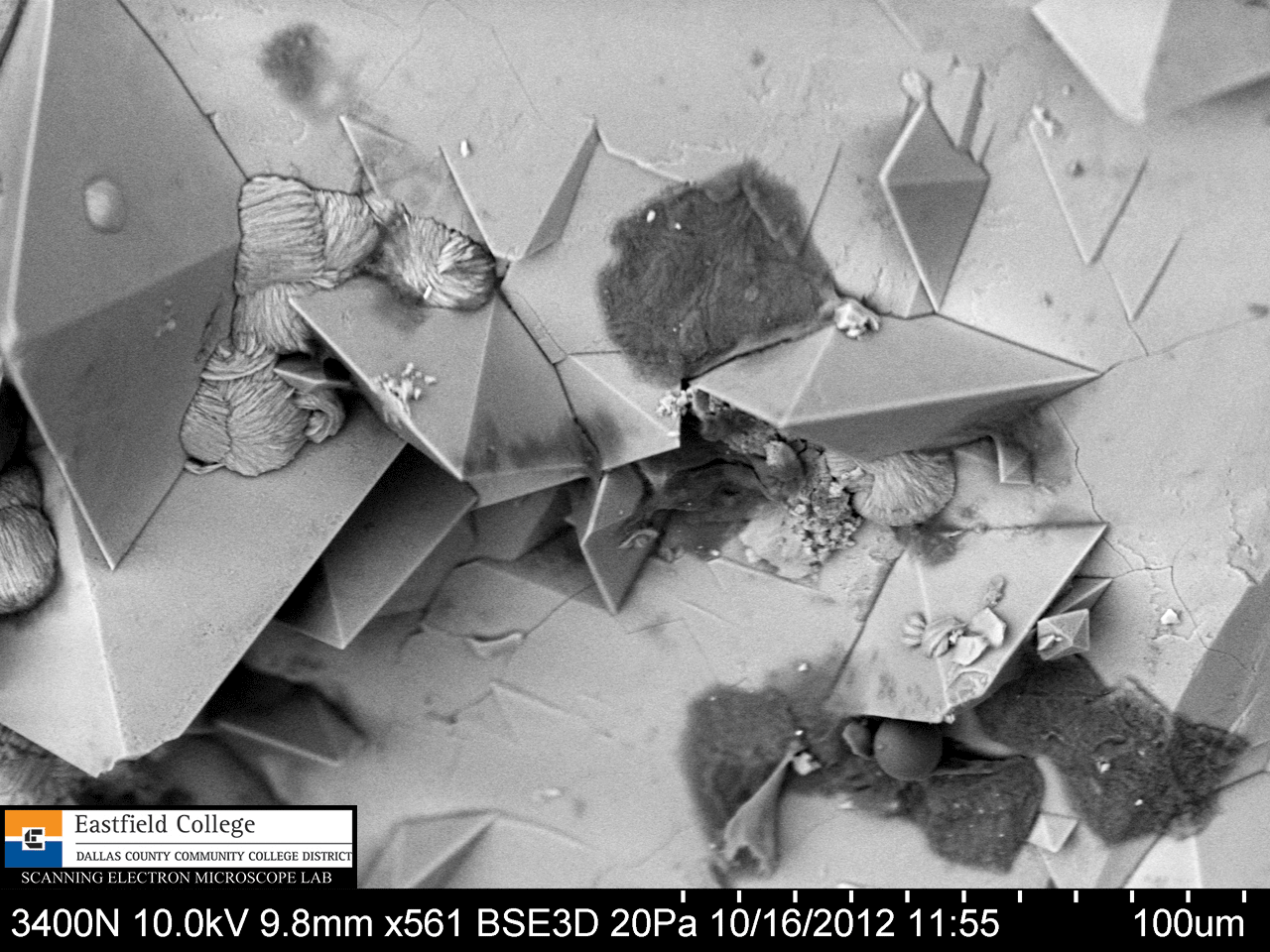 Scanning Electron Microscope Blog: A Kidney Stone - OUCH!!