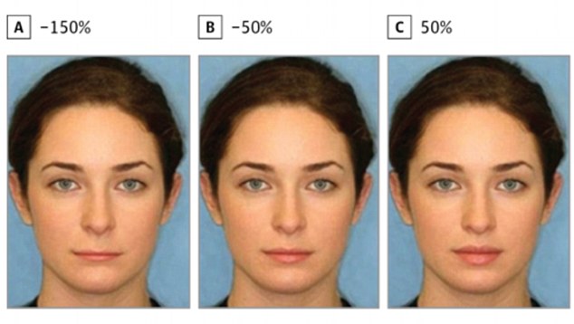 Plastic and Cosmetic Surgery: Science Identifies "Ideal" Female Lip Shape