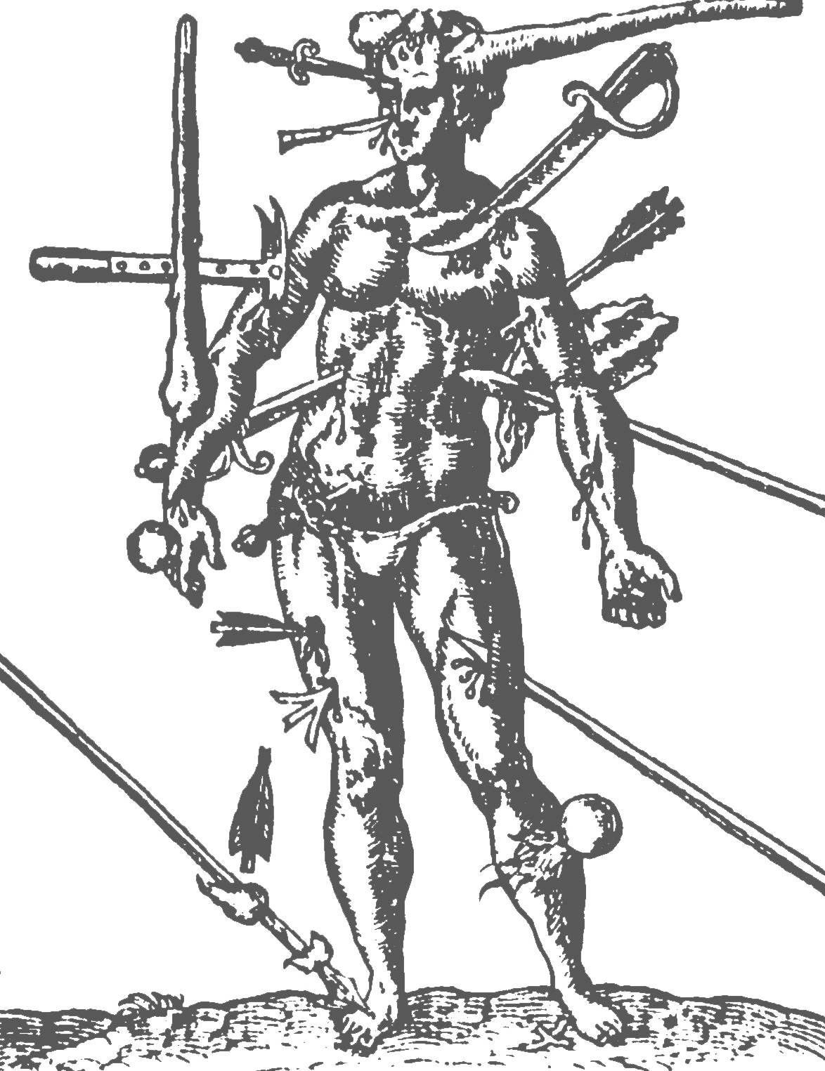 EMS SOLUTIONS INTERNATIONAL by @DrRamonReyesMD marca registrada: WOUND ...