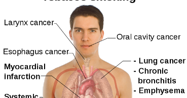 THE EFFECTS OF SMOKING: Smoking Effects on the Human Body