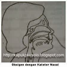 Kesehatan dan Keperawatan: Terapi Oksigen (Aliran Rendah)