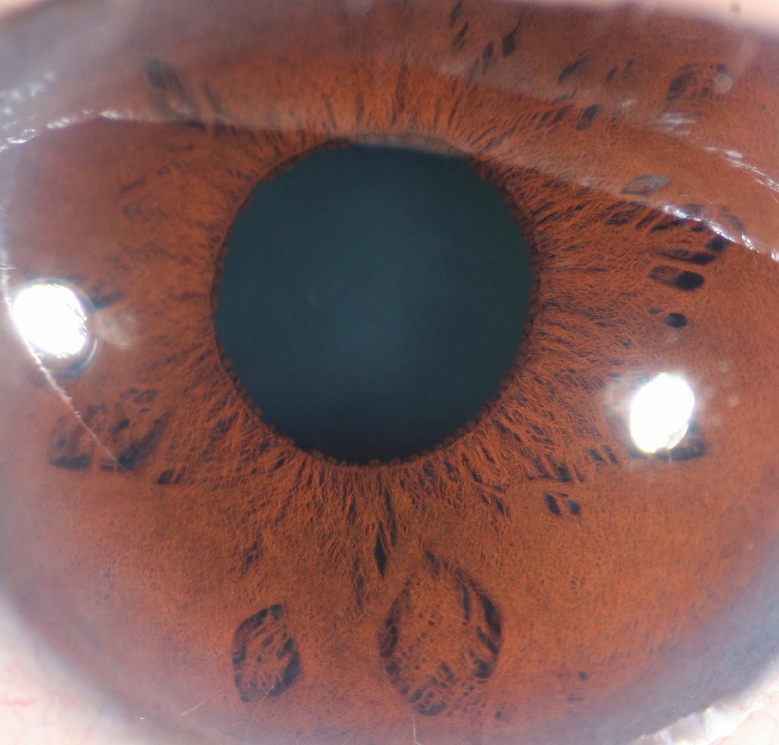 Modern & Multidimensional Iridology: Inner Pupillary Border - Standard ...