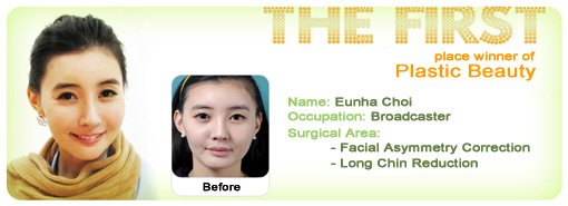 Korea Medical Hub: A broadcaster receives maxillofacial surgery at Real ...