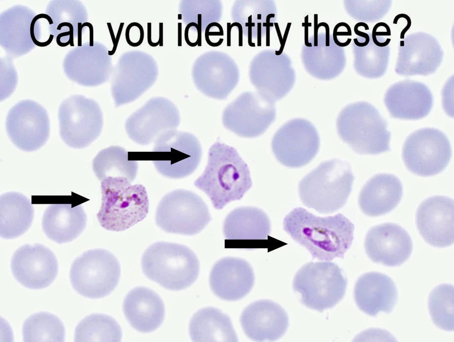 Medical Laboratory and Biomedical Science: Blood parasite challege