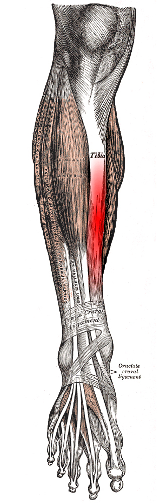 Injury Series: Medial tibial stress syndrome ("shin splints") as a bone ...