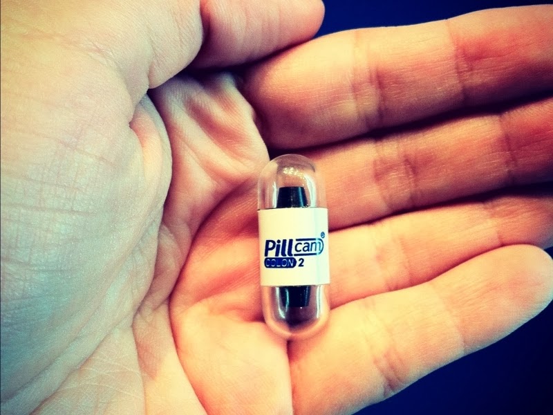 MEDICINA - ENDOSCOPIA DIGESTIVA ALTA : MEDICINA - ENDOSCOPIA DIGESTIVA ALTA