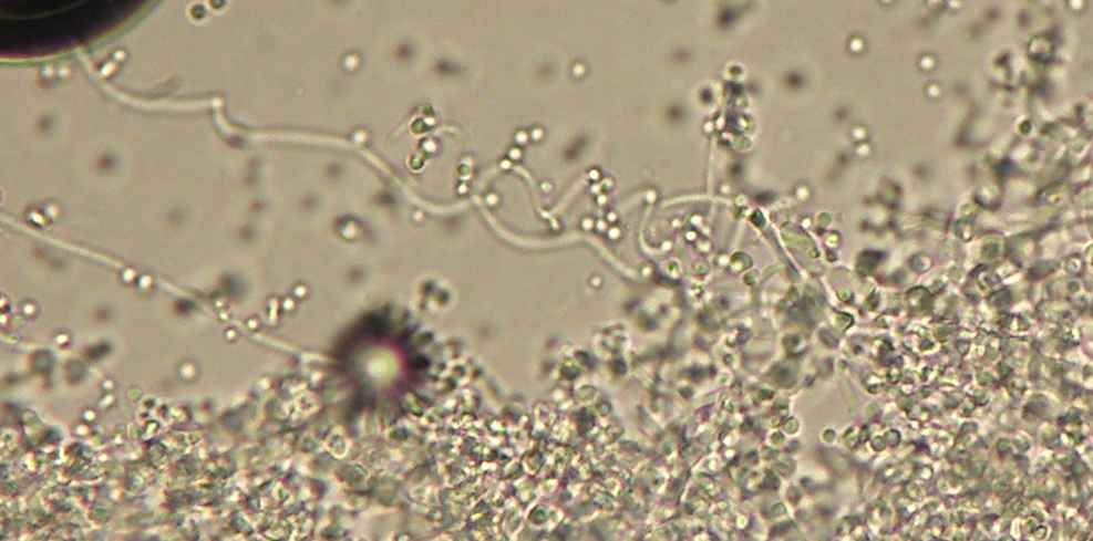 ATLAS MICOLOGIA: TRICHOPHYTON MENTAGROPHYTES