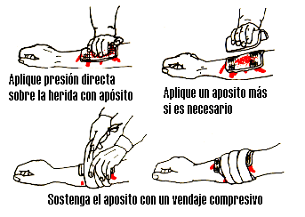 Procedimiento De Atención Para Posibles Accidentes Identificados En La ...