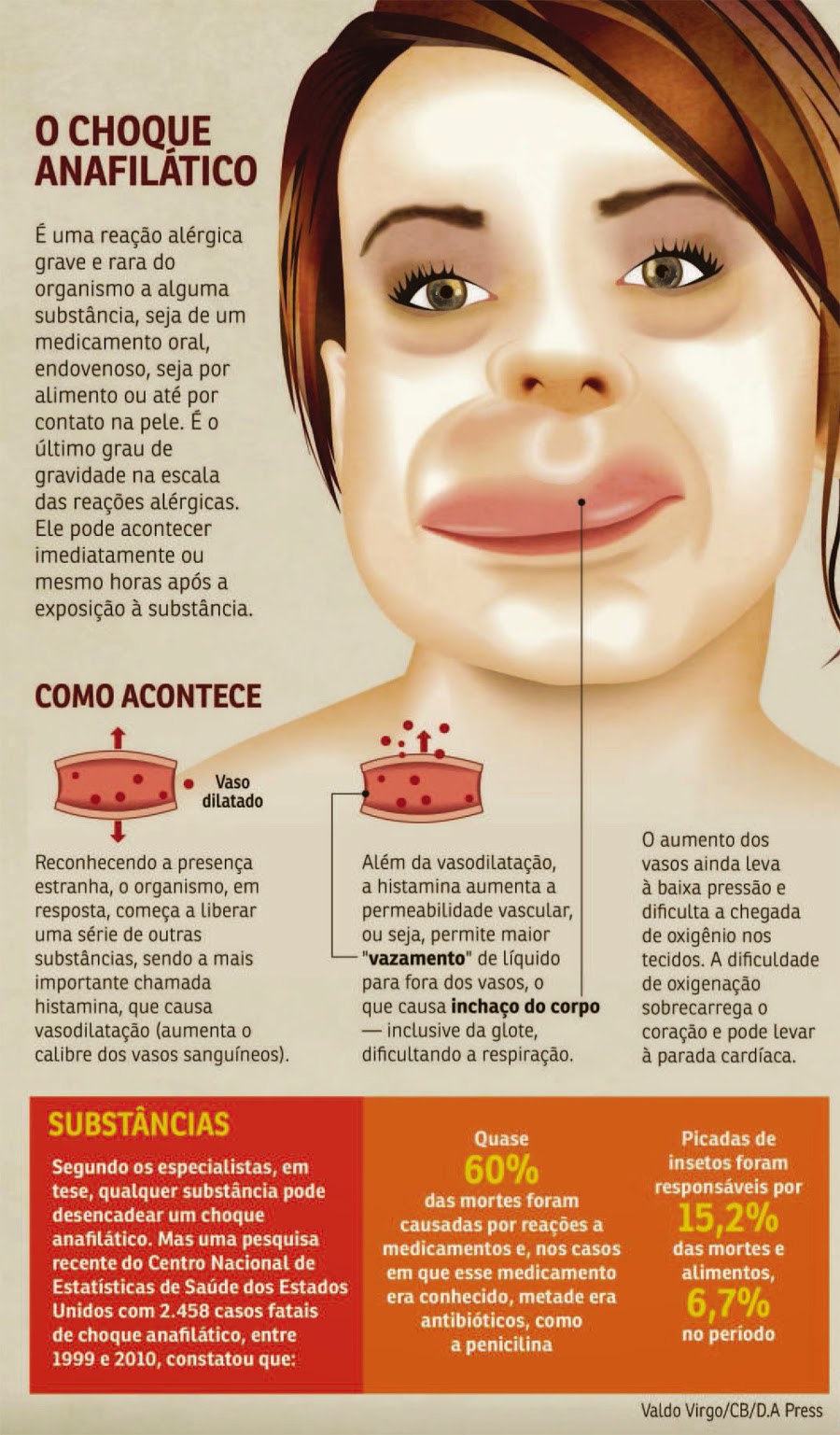 Blog Dr. Carlos: Anafilaxia - Reação anafilática