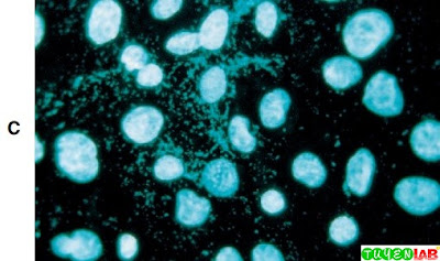 [Microbiology] Atlas of Mycoplasma and Ureaplasma | Free Medical Atlas