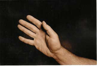 Self Rescue Solutions: The Hitting Hands