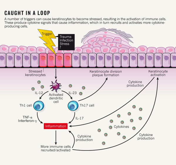 Gene Tonic: La psoriasis: un montón de queratinocitos