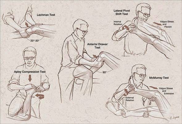 Médicalement Geek: Rhumatologie - Orthopédie