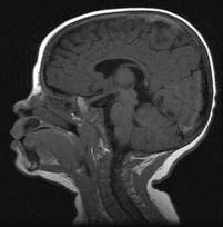 Medical Treatment Pictures-for Better Understanding: Infantile ...
