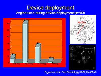 Pedi cardiology: Echo: ASD, TEE evaluation of rims for Transcatheter ...