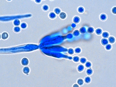 Fun With Microbiology (What's Buggin' You?): Penicillium citrinum