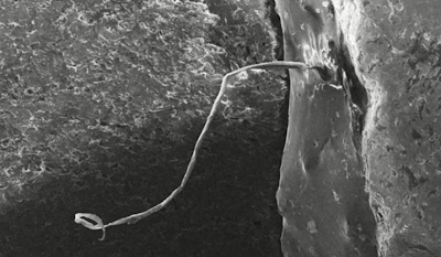 Daily 2 Cents: Alien Implants Harder Than Diamond -- Another Falkville ...