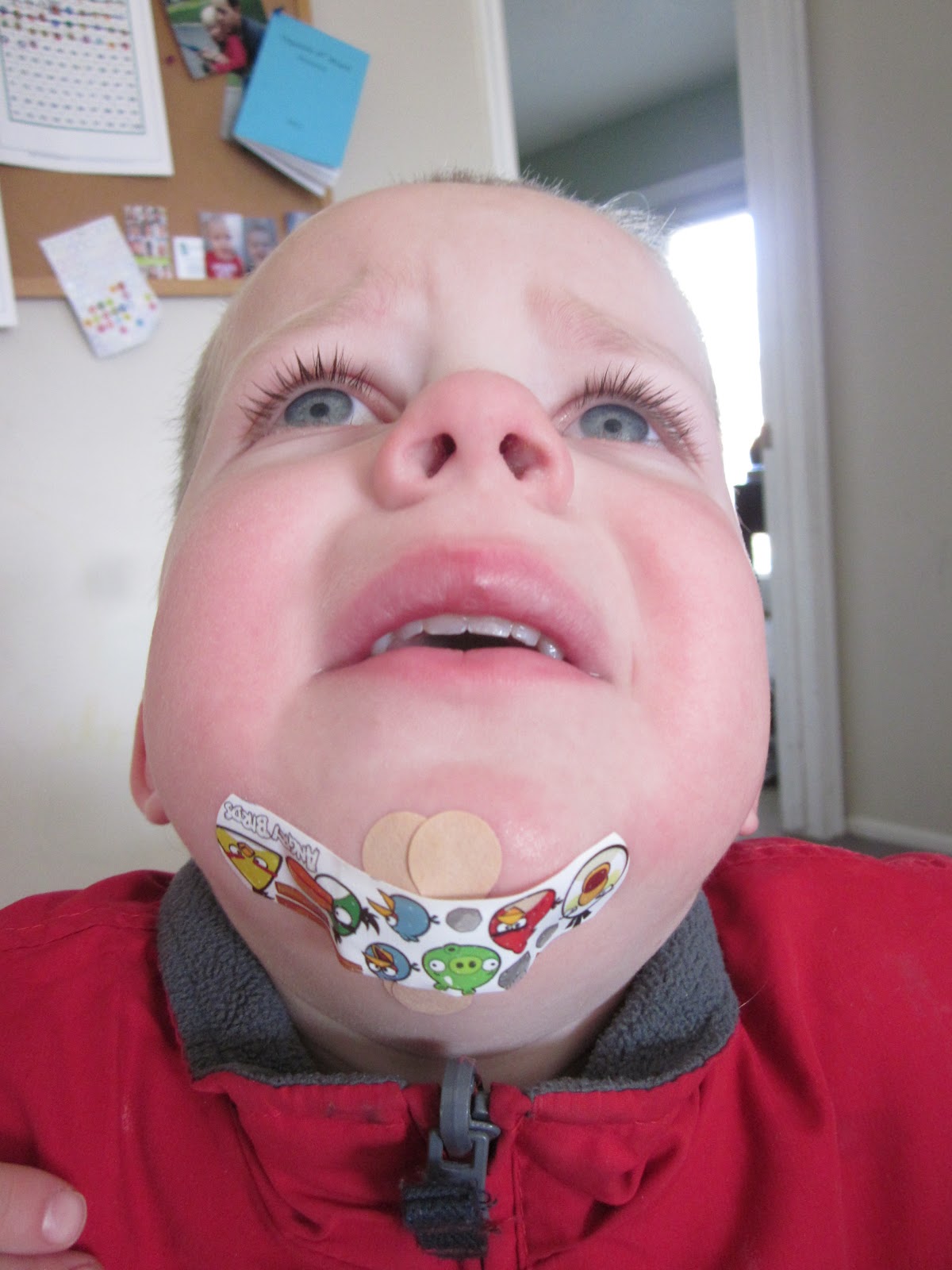 Life Happens: The chin that cracked