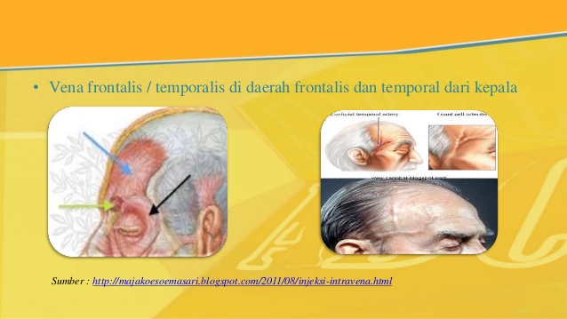 Quality Online Education: Obat dan Dasar dasar Penyuntikan