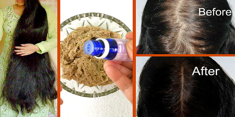 Stop Severe Hair Fall Dandruff Regrow New Hair 100 Works The