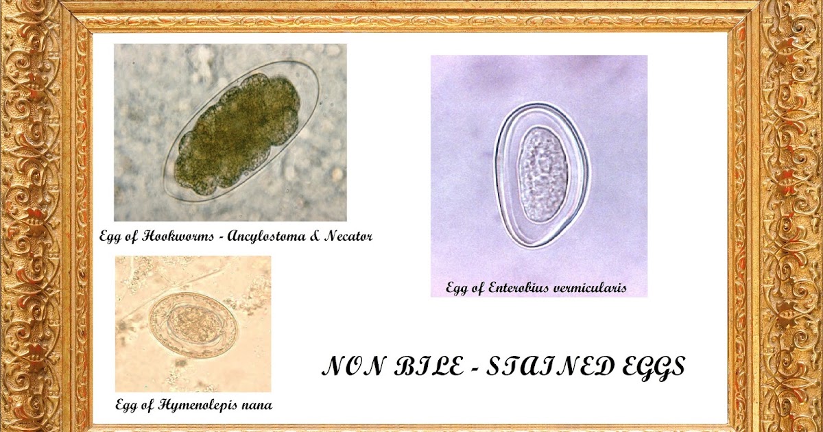 Little Ones Around Us!!: NON BILE STAINED EGGS - PARASITES