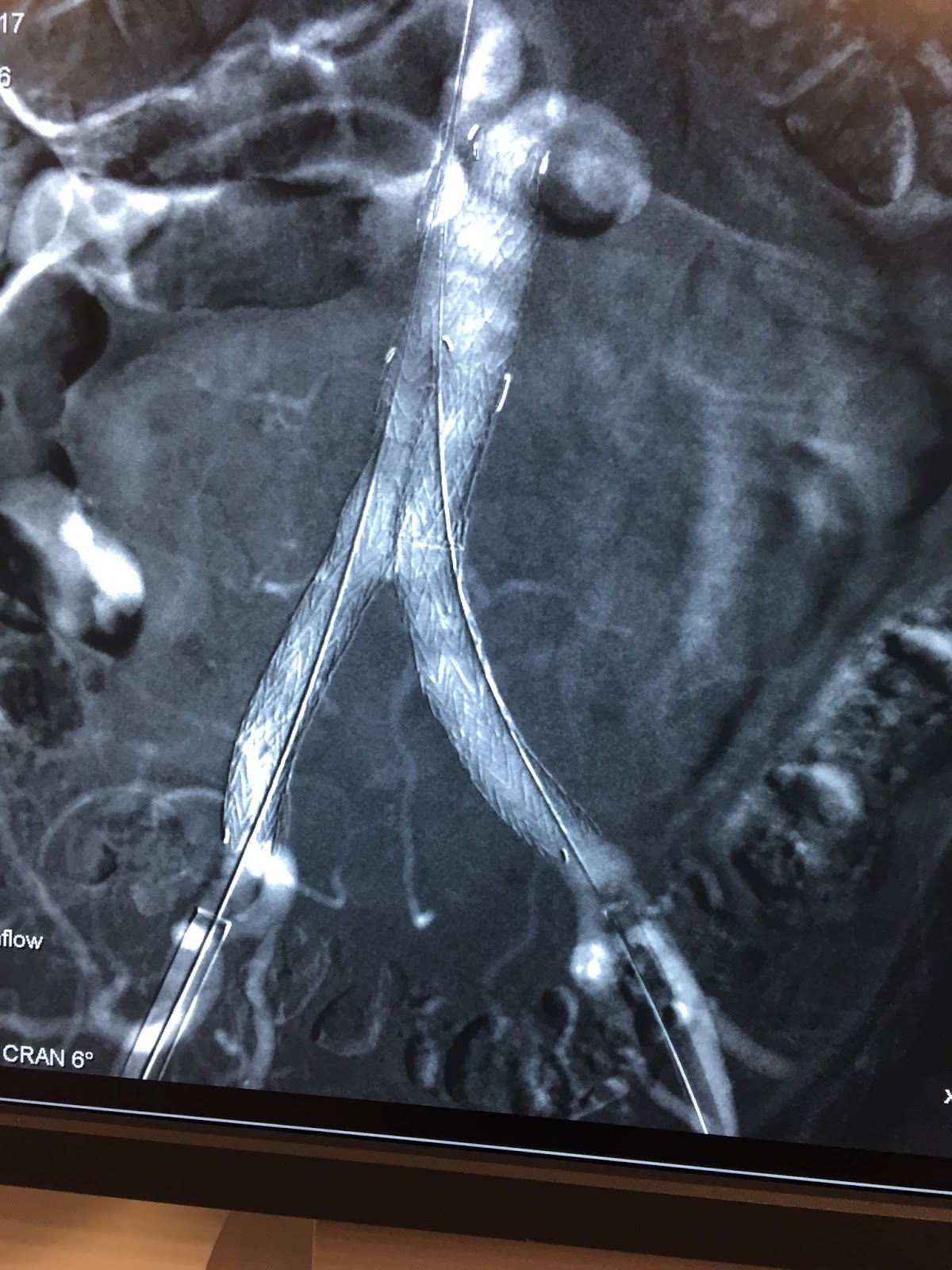 Noticias Logimed: ANGIODROID