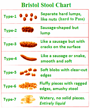 7 Types of Bristol Stool Scale with their Position | Modern Herbalife