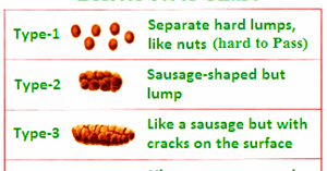 7 Types of Bristol Stool Scale with their Position - Modern Herbalife