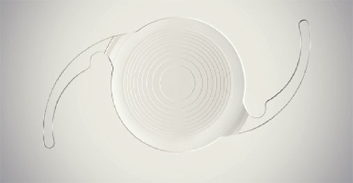 Upgrading to Multifocal and Toric IOLs - Eyedolatry