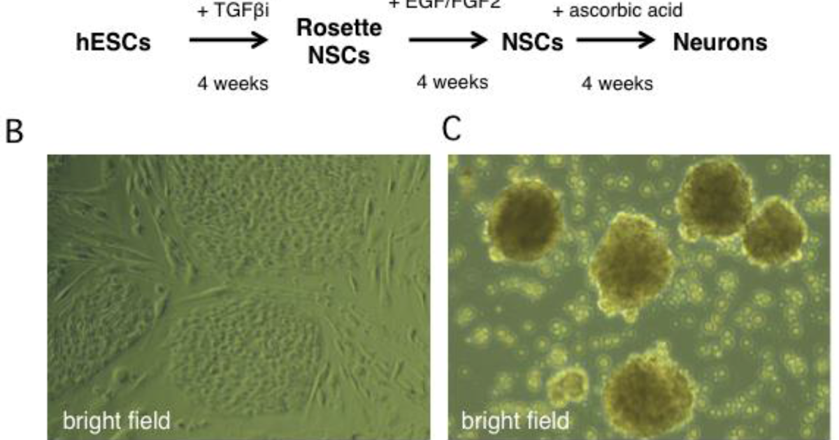 Neuromics: Modeling HIV Latency