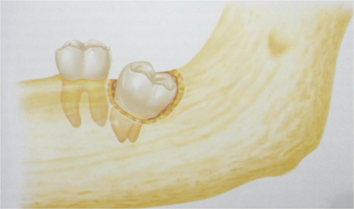 Siso Pra Que Te Quero: O QUE É UM SISO INCLUSO?