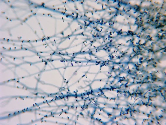 Fun With Microbiology (What's Buggin' You?): Ochroconis species