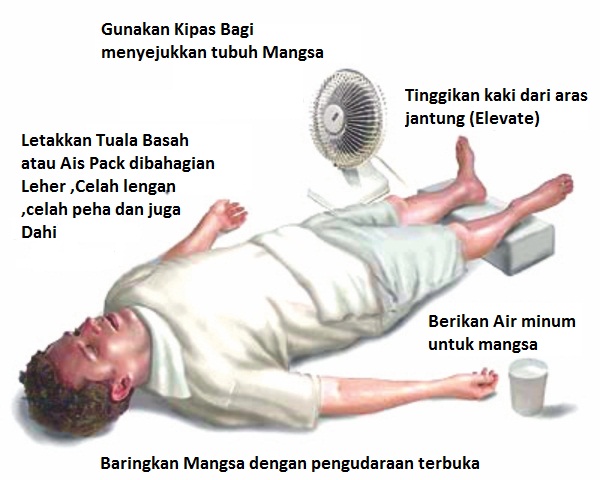 Bahaya Stroke Haba pada badan manusia ~ akufisio.blogspot