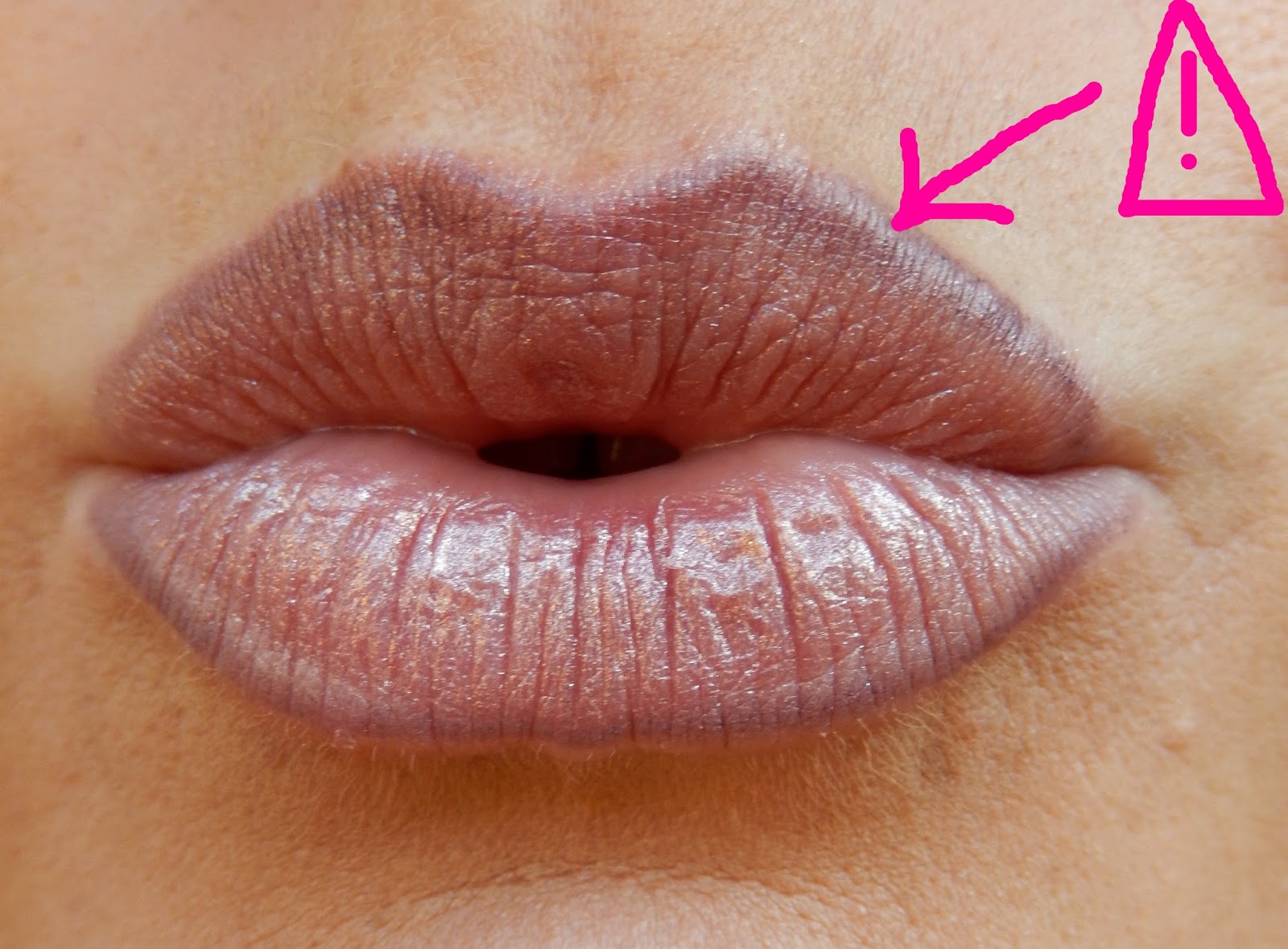 Point rouge dans la bouche - curcu28lektman