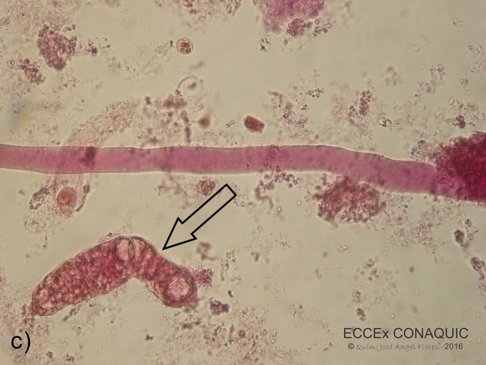 Examen General de Orina: marzo 2016