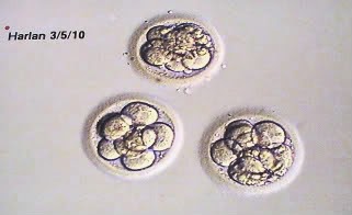 Embryo For Life: Aprendendo a Classificação dos Embriões